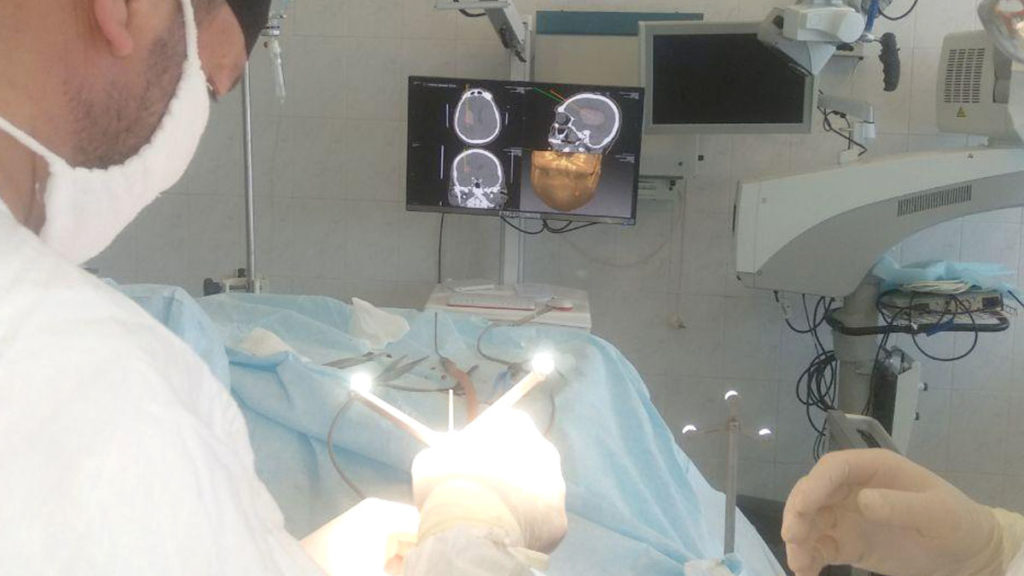 AUTOPLAN — Surgical navigation system